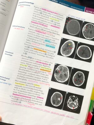 Best Way to Annotate USMLE Step 1 First Aid for Studying – Lily In Medicine